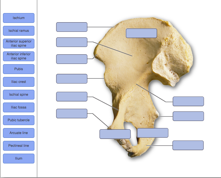 Solved Ischium Ischial ramus 0 Anterior superior iliac spine | Chegg.com