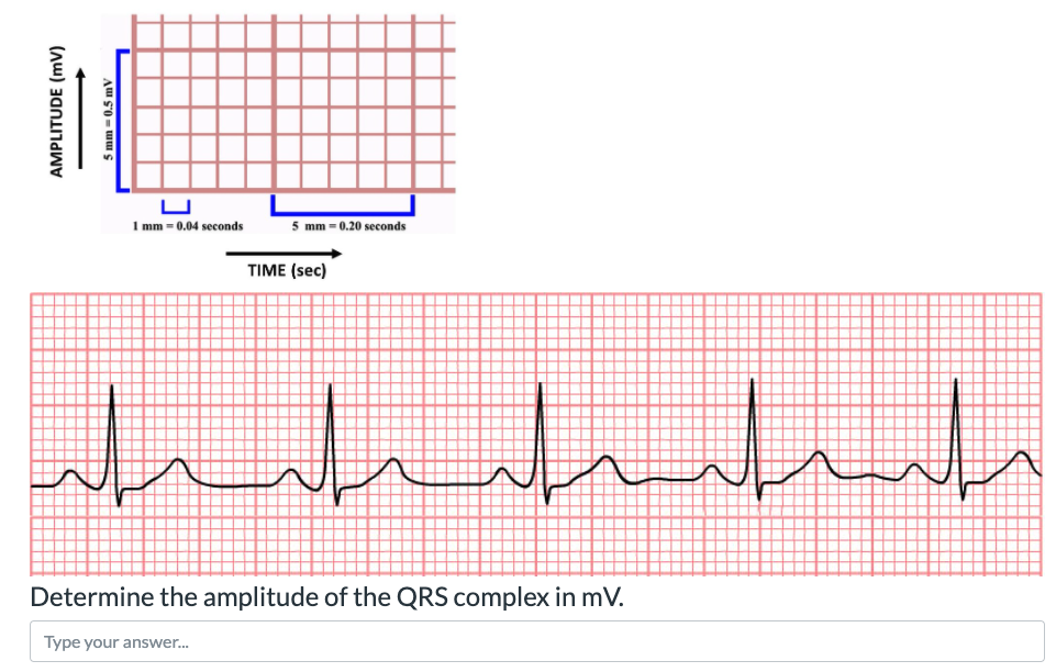 Solved AMPLITUDE (mv) 5 min = 0.5 mV لا 1 mm -0.04 seconds 5 | Chegg.com