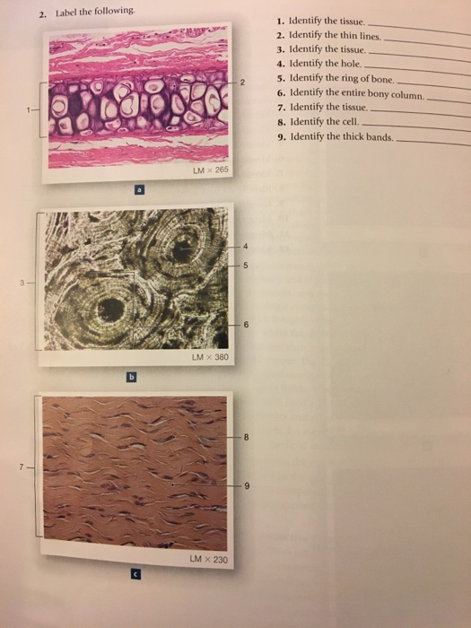 Solved Label the following about connective tissues. | Chegg.com Solved Label the following about connective tissues. | Chegg.com
