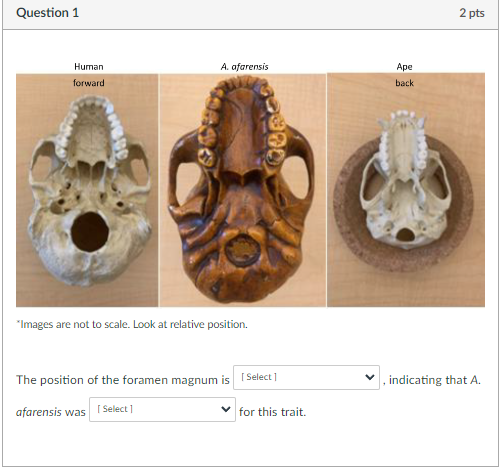 Solved The position of the foramen magnum is [ Select ] | Chegg.com