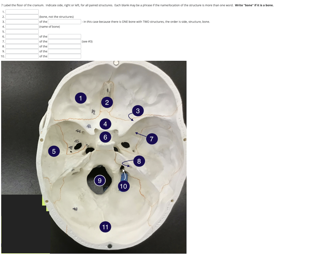Solved Label the floor of the cranium 1-10. ﻿Indicate side, | Chegg.com
