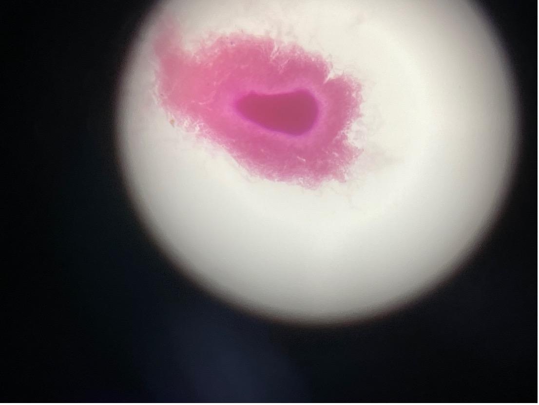 Solved What is the shape of the bacteria below, describe it. | Chegg.com