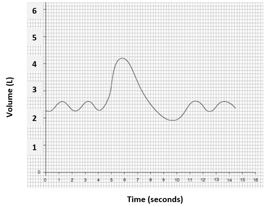 Solved Below is a Spirograph from a patient who has | Chegg.com