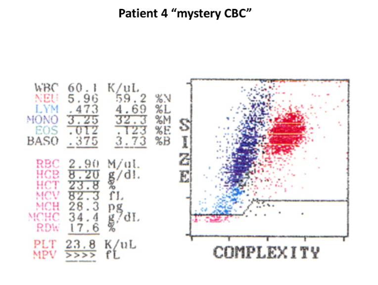 Solved CBC from a normal patient scan and readout: WBC M0 | Chegg.com