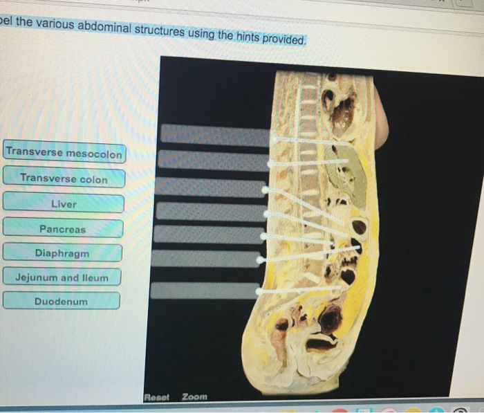 Solved el the various abdominal structures using the hints | Chegg.com