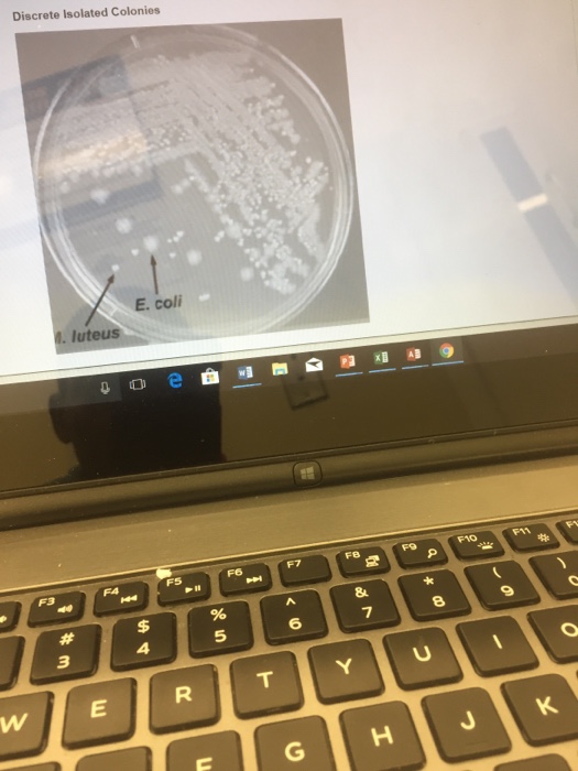 Solved Describe the colony morphology color ,elevation | Chegg.com