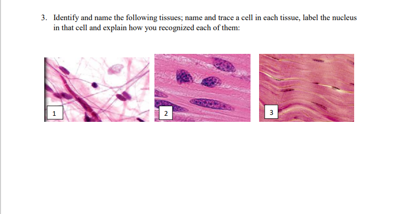 Solved 1. Draw the 8 Epithelial tissues, name each with | Chegg.com
