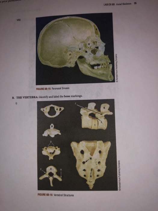 Solved R. Complete this table describing bone classification | Chegg.com