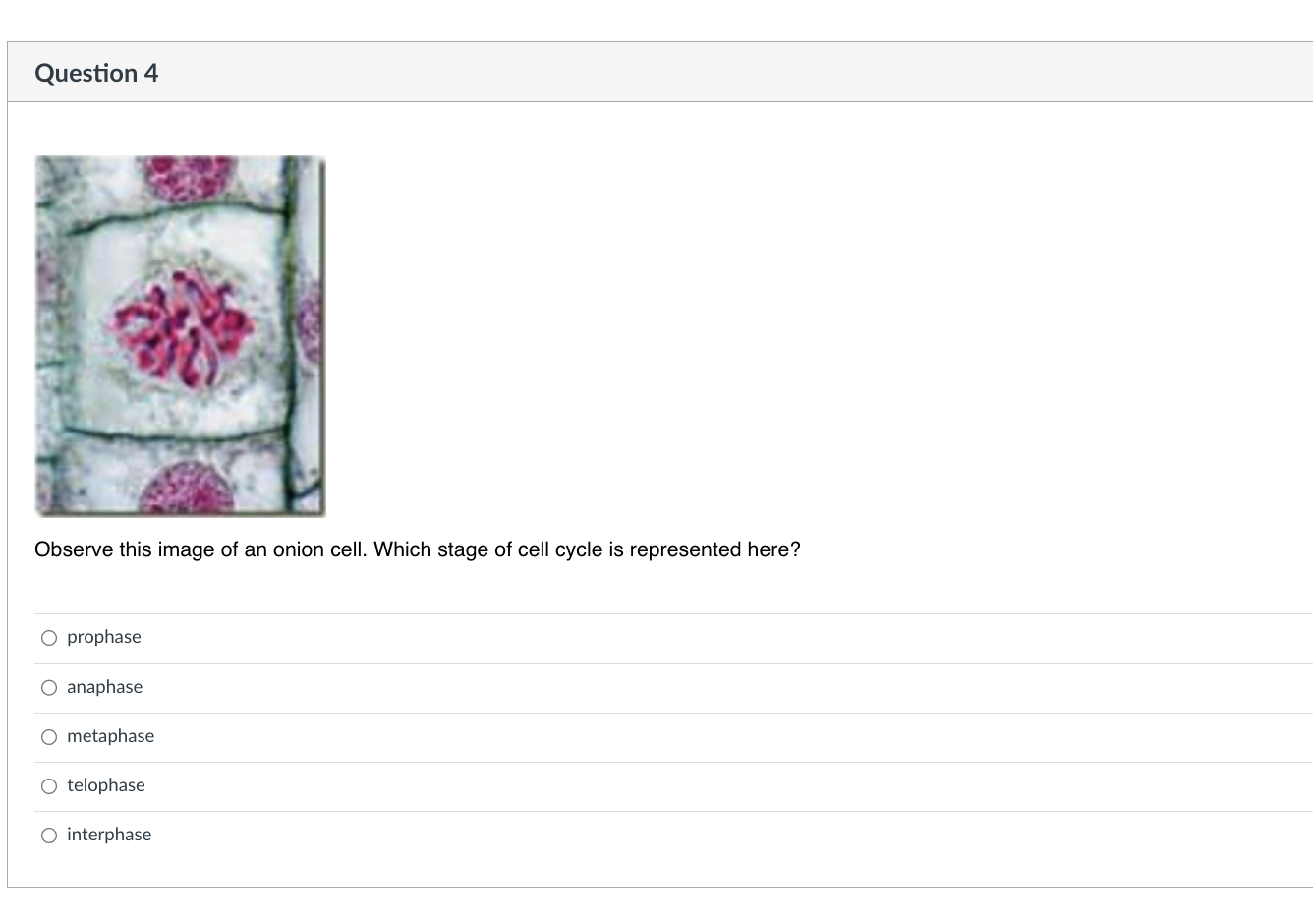 Solved Observe this image of an onion cell. Which stage of | Chegg.com