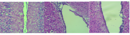 Mice brain H&E staining H&E staining | Chegg.com