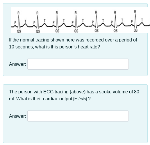 Solved If the normal tracing shown here was recorded over a | Chegg.com
