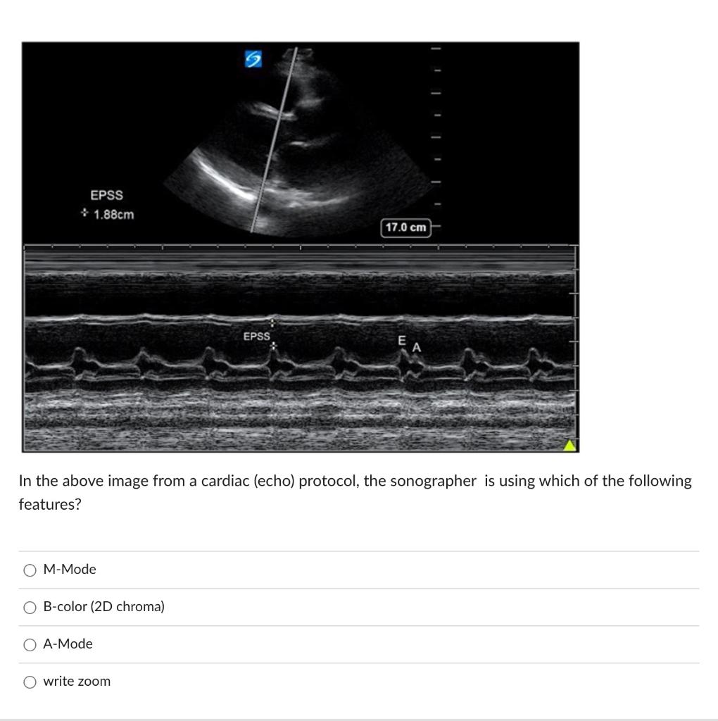 Solved In the above image from a cardiac (echo) protocol, | Chegg.com