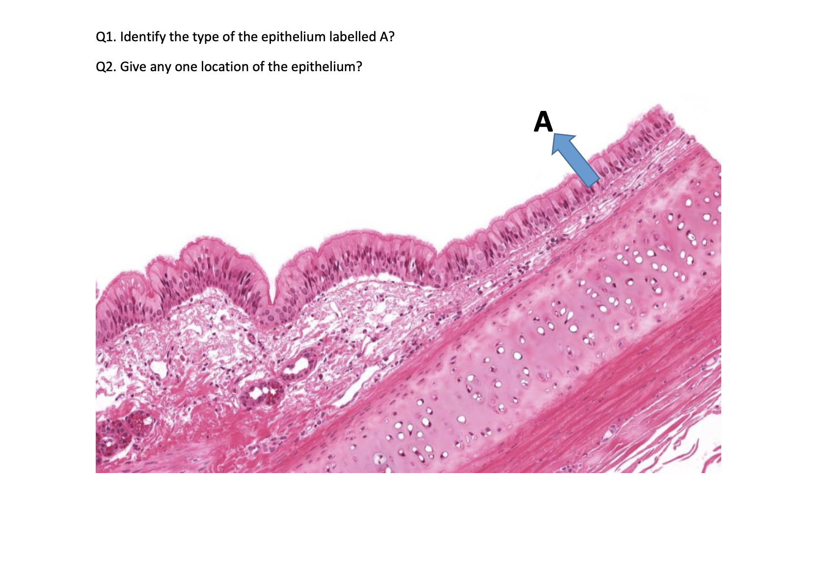 Solved Q1. Identify the type of the epithelium labelled A? | Chegg.com