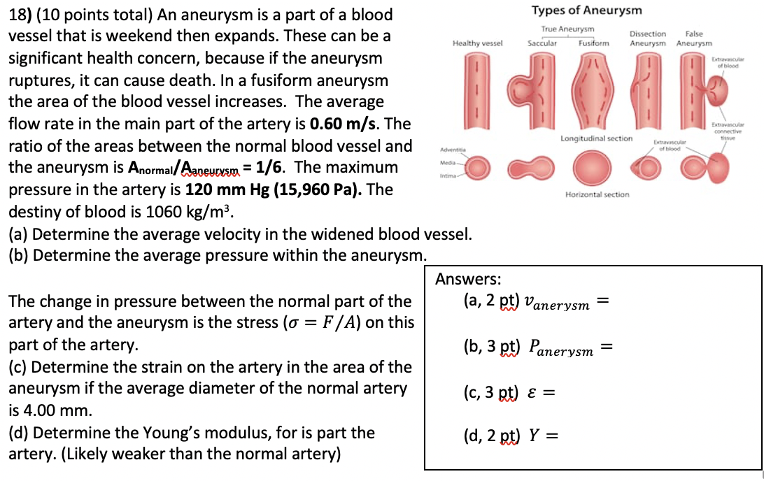 True Aneurysm Saccular Fusiform Healthy vessel | Chegg.com