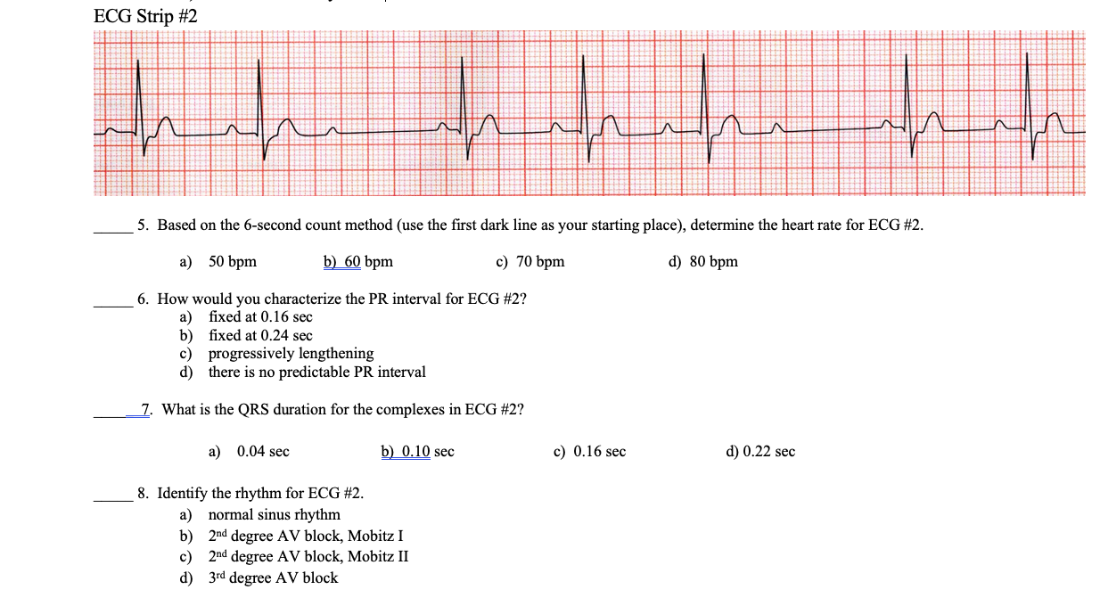 Solved ECG Strip 2 N 5 Based On The 6 second Count Method Chegg
