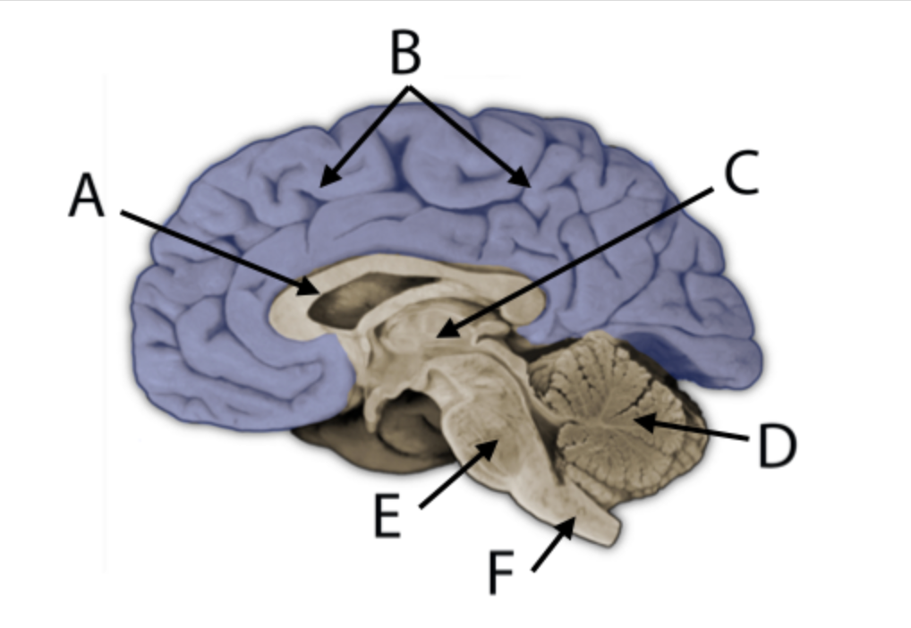 Solved Please label the following | Chegg.com