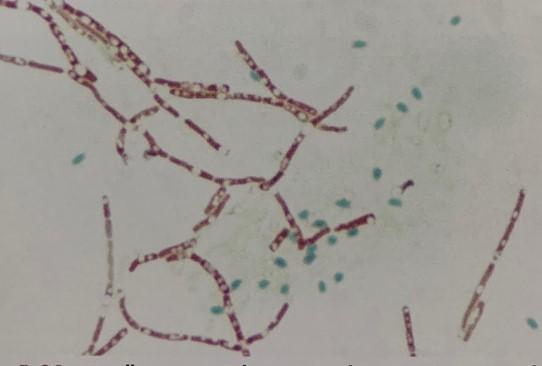 Solved 1. What conclusion can you make about the bacteria in | Chegg.com