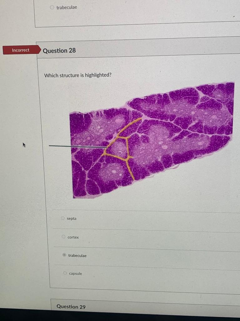 Solved trabeculae Incorrect Question 28 Which structure is | Chegg.com