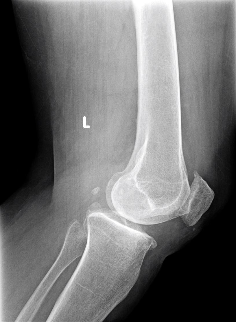 9.34 AM Thu Apr 6 Radiology Report PATIENT INITIALS: | Chegg.com