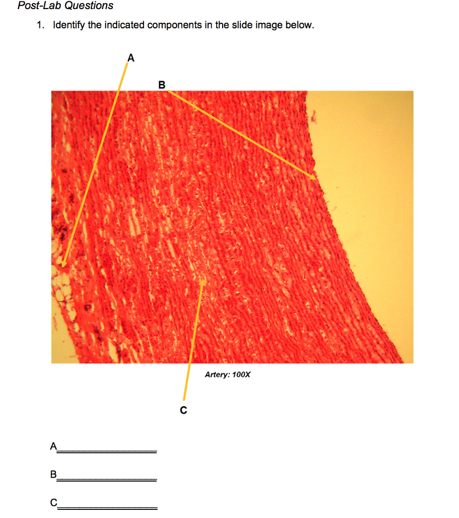 Solved Post-Lab Questions 1. Identify the indicated | Chegg.com Solved Post-Lab Questions 1. Identify the indicated | Chegg.com