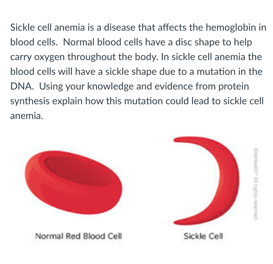 Solved Sickle cell anemia is a disease that affects the | Chegg.com