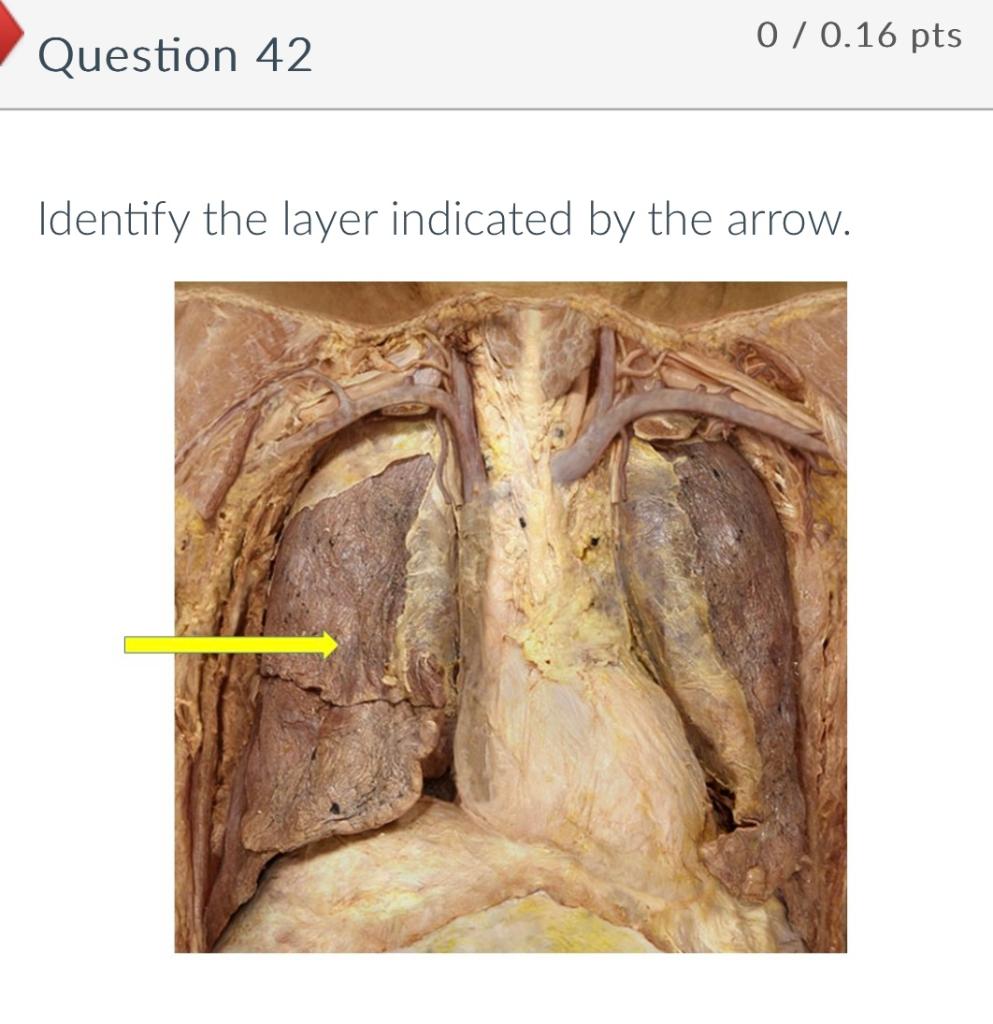 Solved Identify the structure indicated by the | Chegg.com