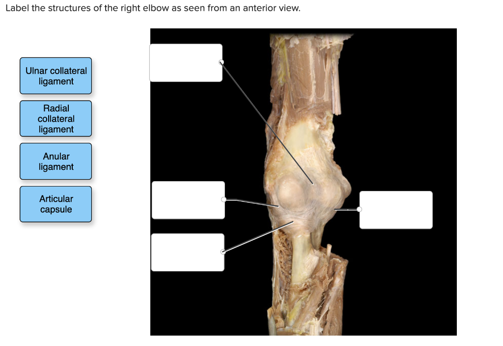 Solved Label the structures of the right elbow as seen from | Chegg.com