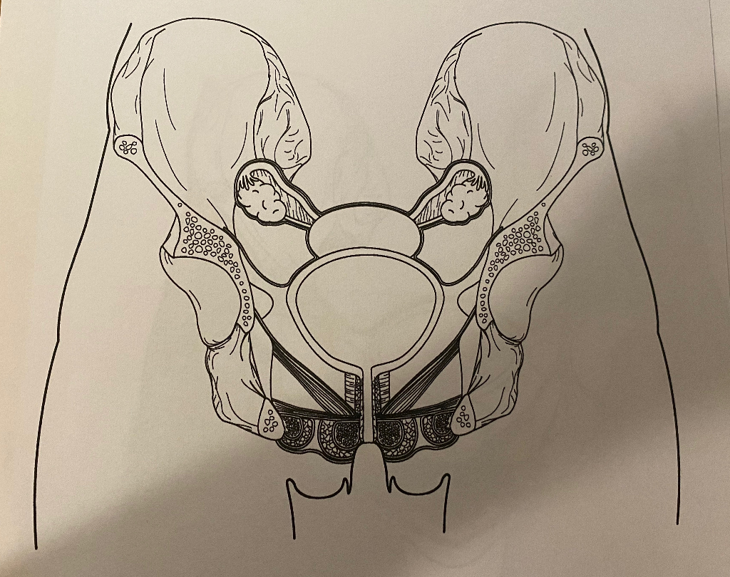 Solved 1. Color the pelvic floor blue 2. Outline the pelvic | Chegg.com