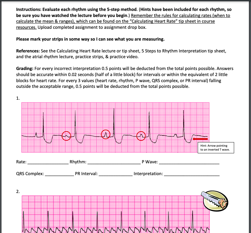 Solved Rate: Rhythm: P Wave: QRS Complex: PR Interval: | Chegg.com