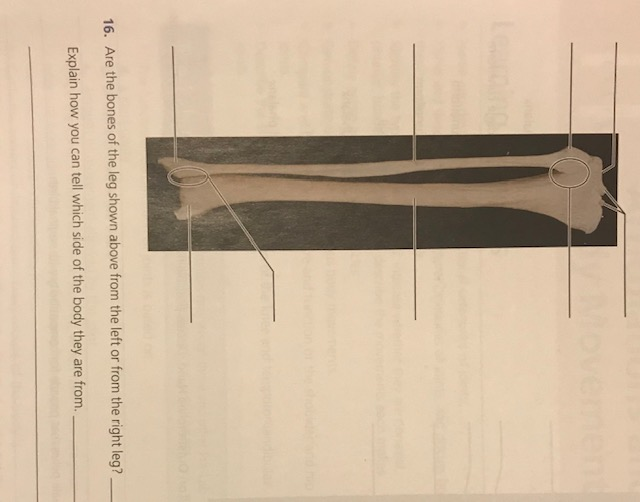 Solved Are the bones of the leg shown above from the left | Chegg.com