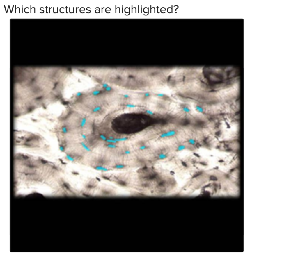 Solved Which structures are highlighted? Bone C. D. Blood | Chegg.com