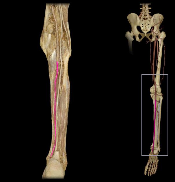 Anterior Tibial Artery Cadaver