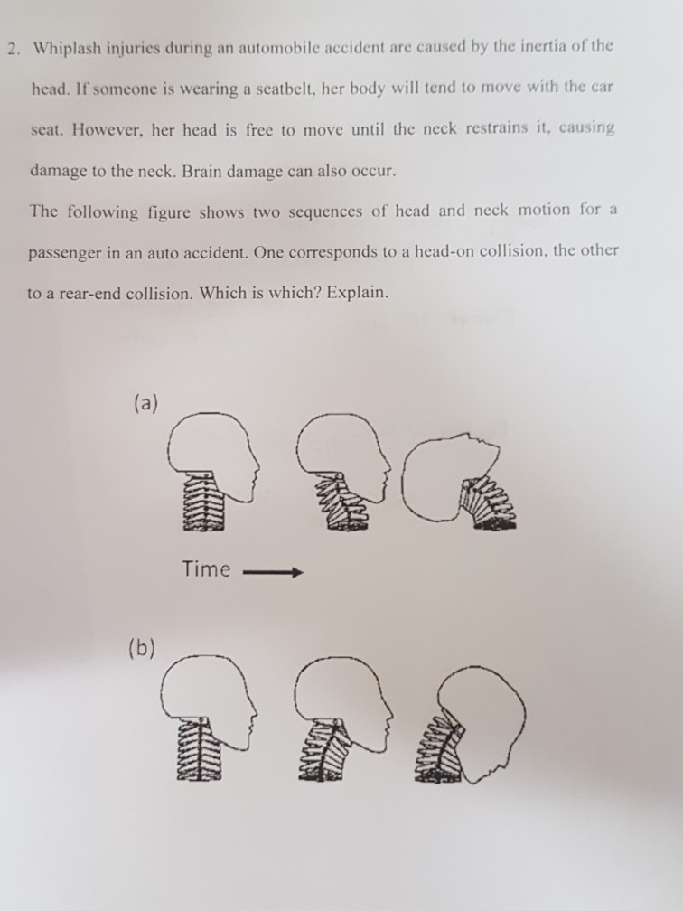 Solved 2. Whiplash injuries during an automobile accident | Chegg.com