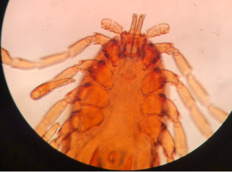 Solved Image the whole mount slide of the tick, showing a | Chegg.com