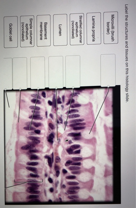 Solved Label the structures and tissues on this histology | Chegg.com Solved Label the structures and tissues on this histology | Chegg.com