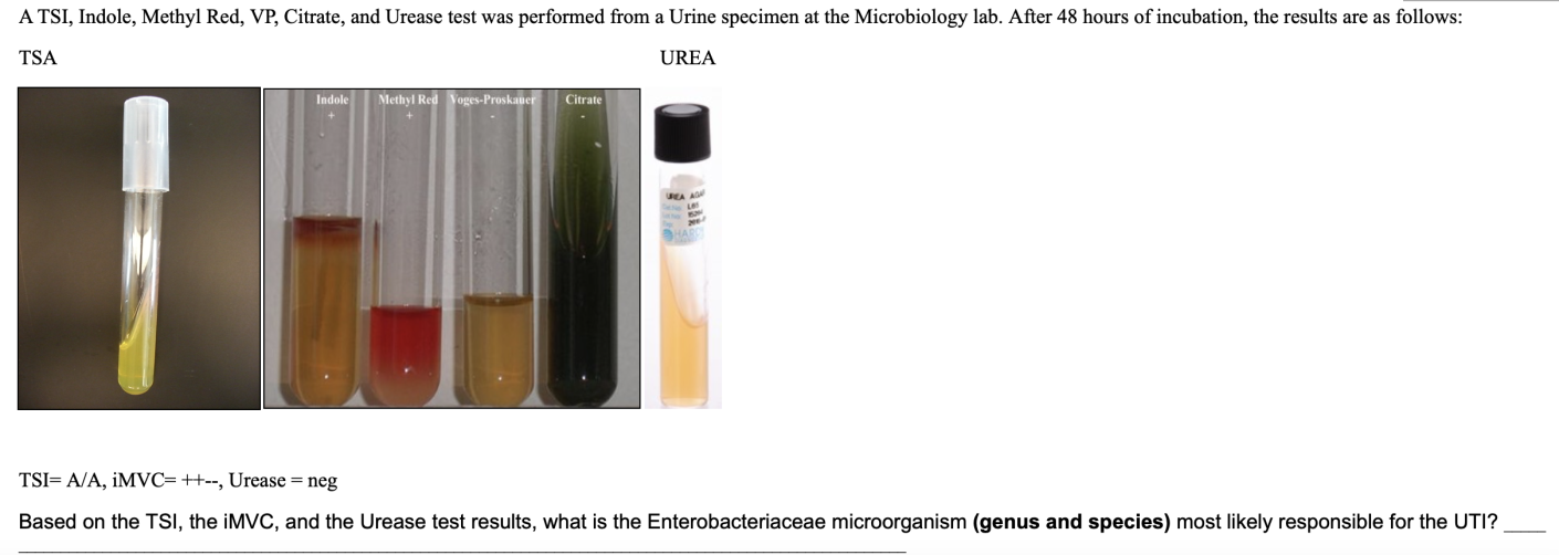 Solved A TSI, Indole, Methyl Red, VP, Citrate, and Urease | Chegg.com