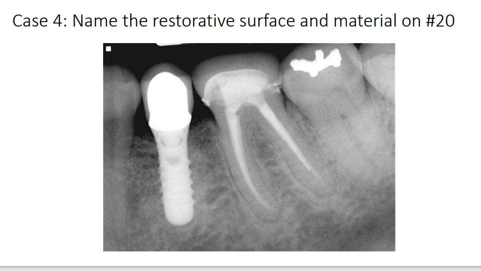 Solved Case 4: Name the restorative surface and material on | Chegg.com