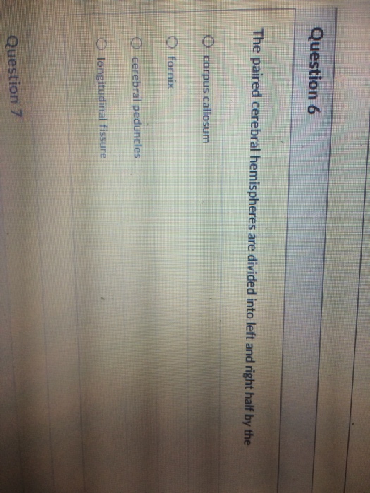 Solved Nervous system questions | Chegg.com