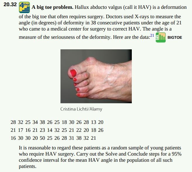 Solved 2032 4 A Big Toe Problem Hallux Abducto Valgus