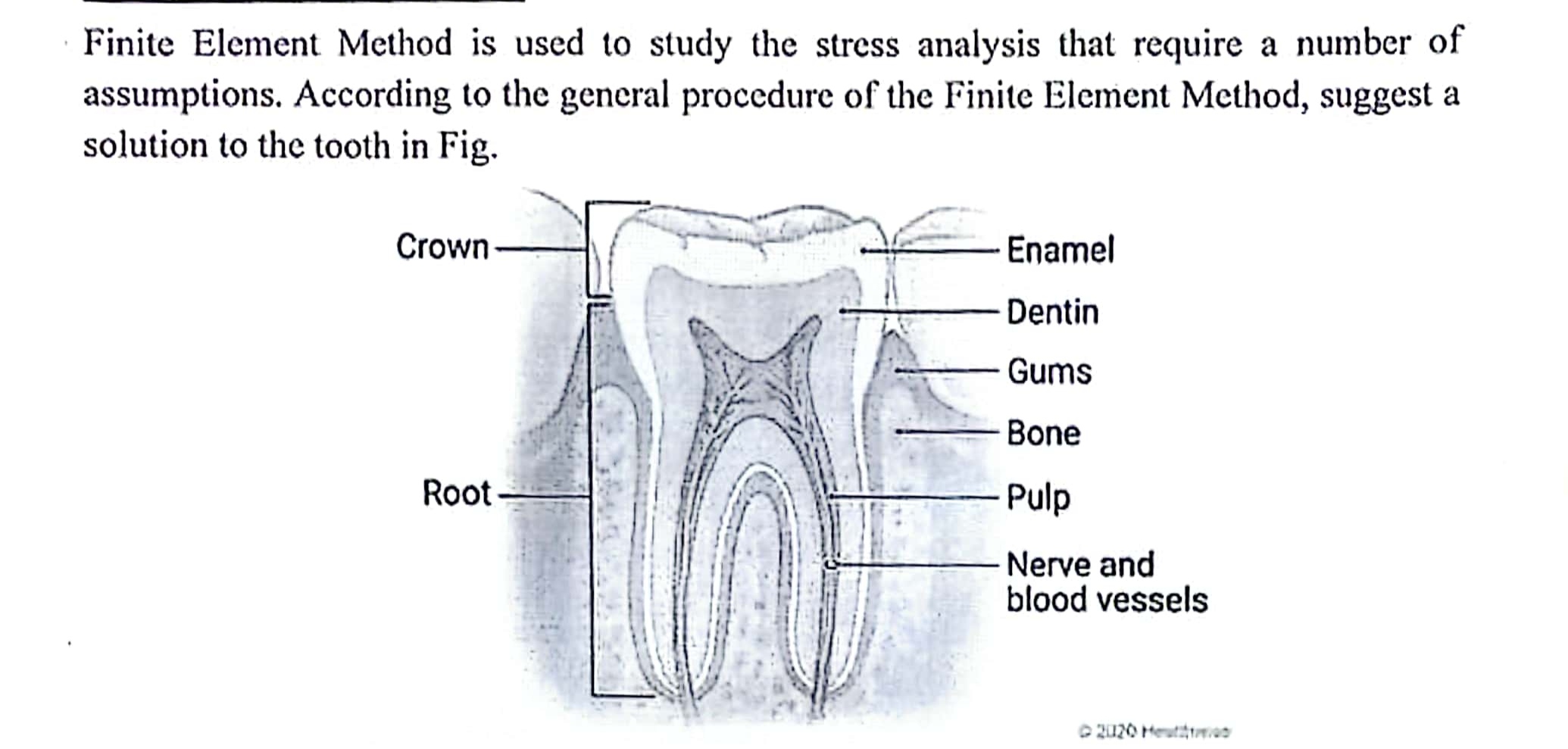 Solved Finite Element Method is used to study the stress | Chegg.com