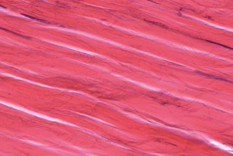 Solved This is a Dense Regular Connective Tissue | Chegg.com