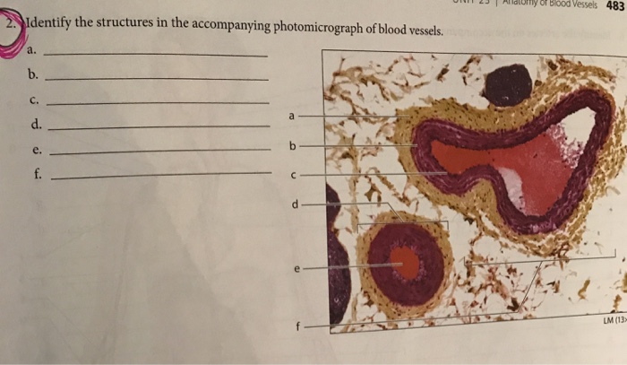 Solved Activity 3: Identifying Veins That Drain into the | Chegg.com