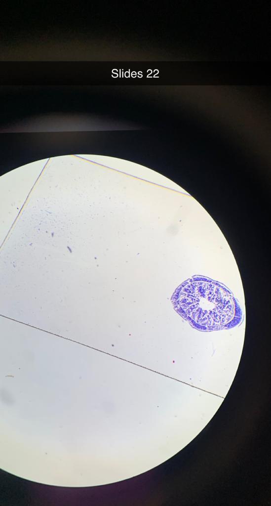 Solved In this pre-made slide of hydra with testis t.s | Chegg.com