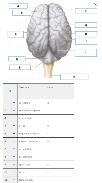 Solved Brain Labeling- I started but I was not too sure. | Chegg.com