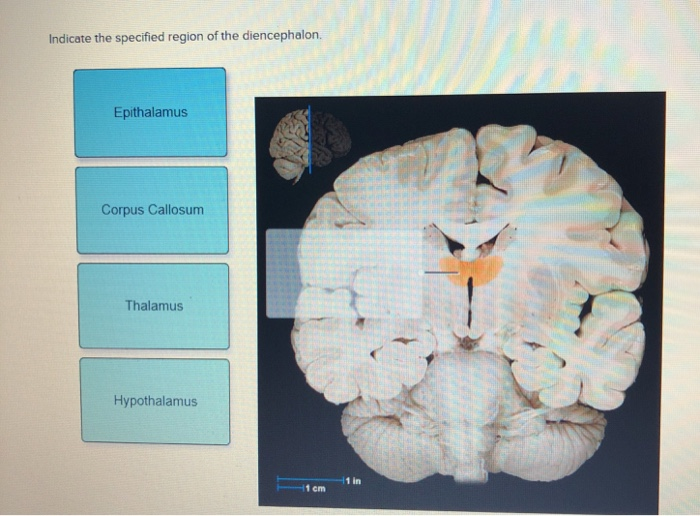 Solved Indicate the specified region of the diencephalon. | Chegg.com