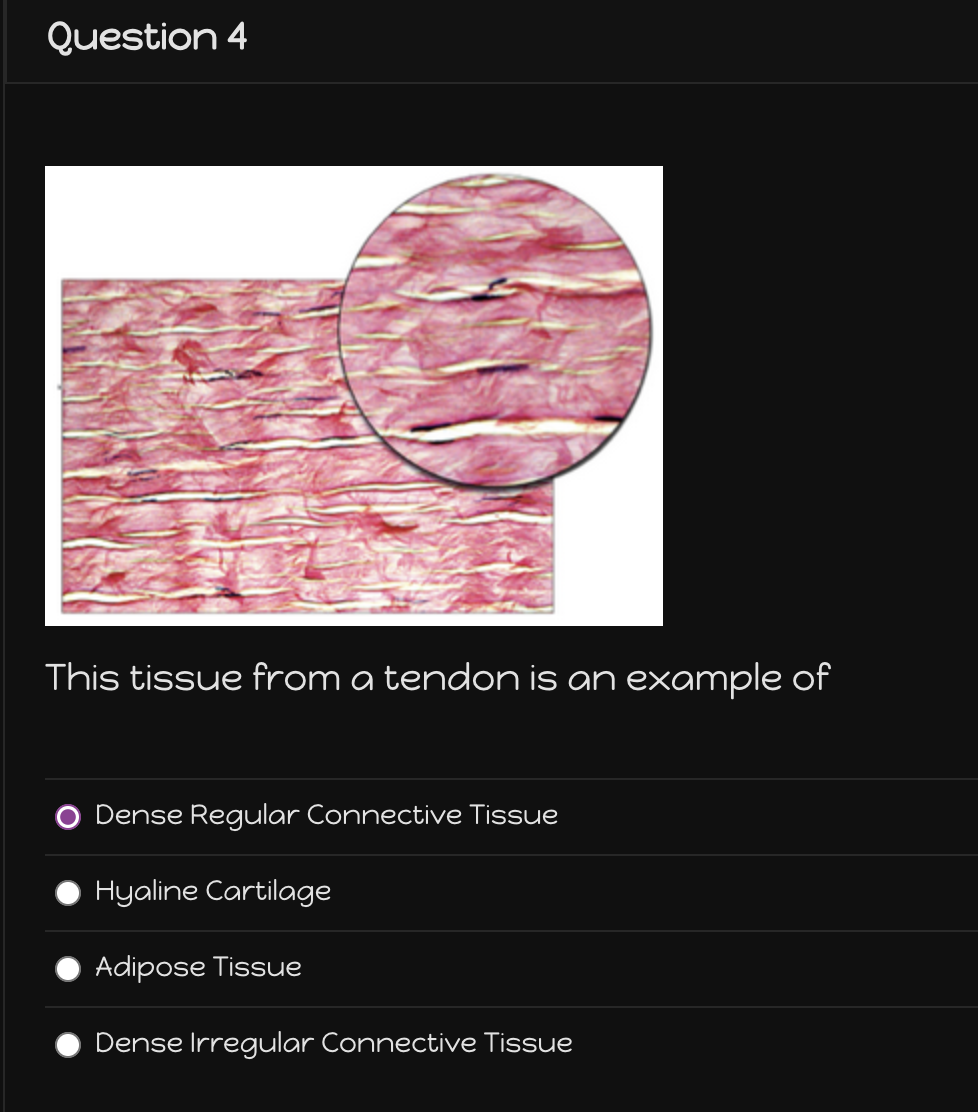 Solved Question 4This tissue from a tendon is an example | Chegg.com