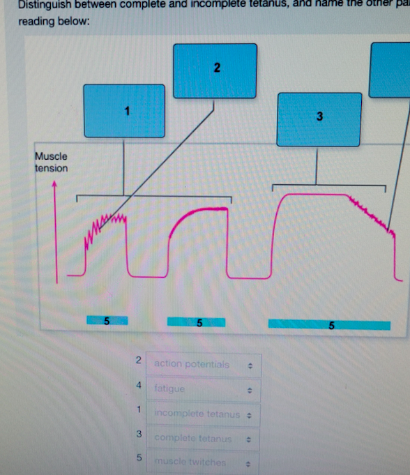 Solved Distinguish between complete and incomplete tetanus, | Chegg.com Solved Distinguish between complete and incomplete tetanus, | Chegg.com