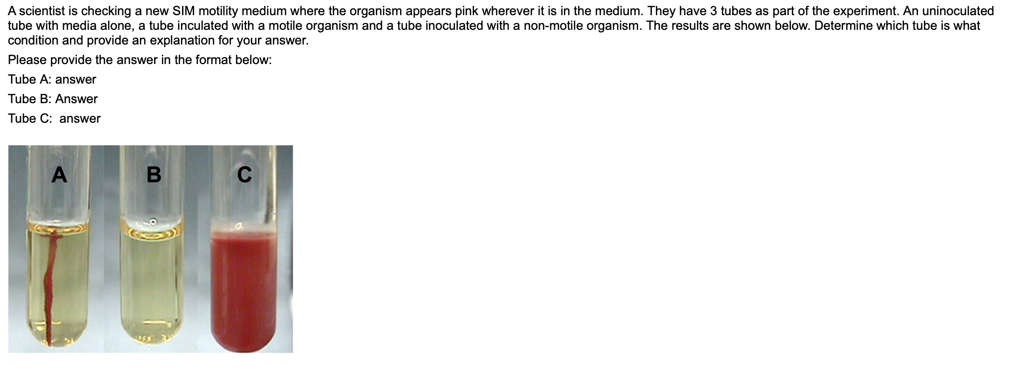 Solved A scientist is checking a new SIM motility medium | Chegg.com