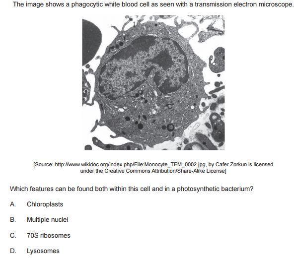 Ribosomes Microscope