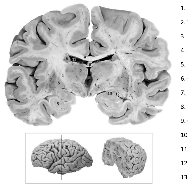 Solved Η Ν α τ ιο ο Ν ο σ 8 Ε Ν 13 12 3 ή και * | Chegg.com